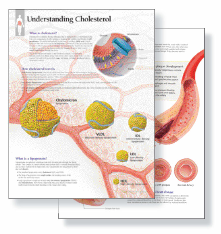 Understanding Cholesterol Study Set (Replacement pads) | Scientific Publishing