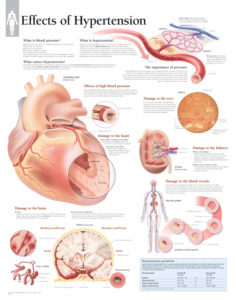 Effects of Hypertension - Scientific Publishing