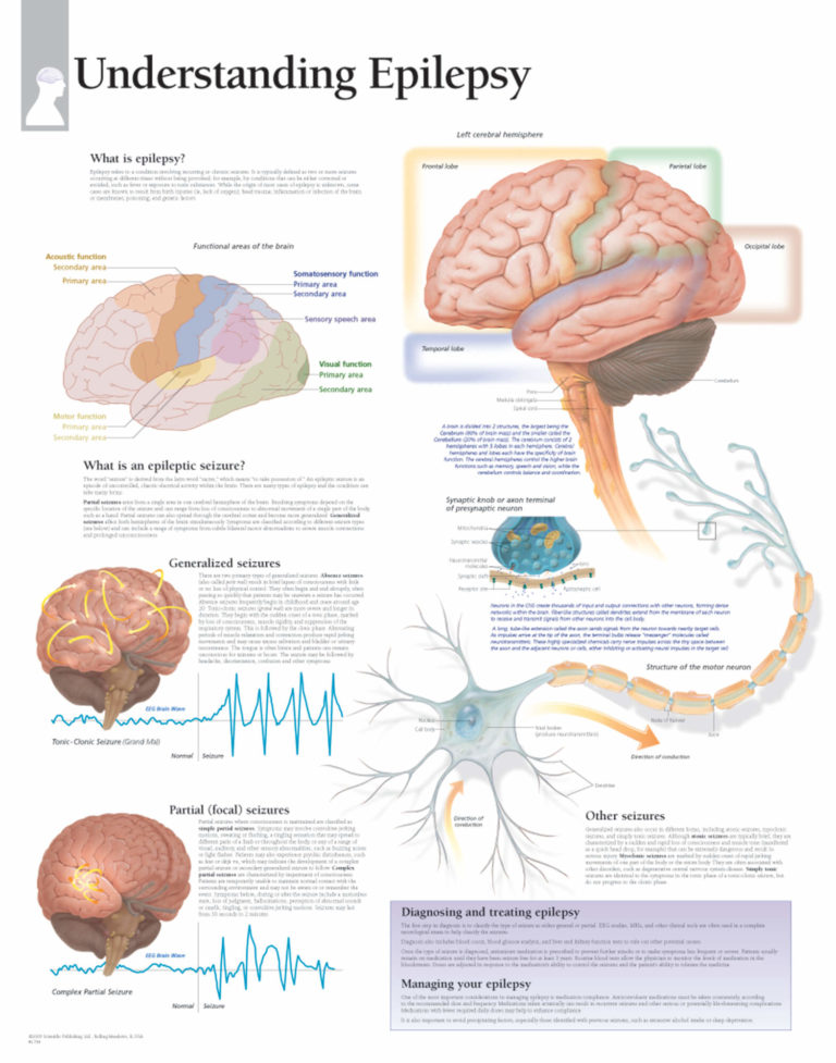 Understanding Epilepsy | Scientific Publishing
